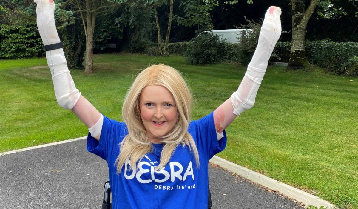 Laois hero Emma launches StepTember fundraiser for Debra Ireland ...