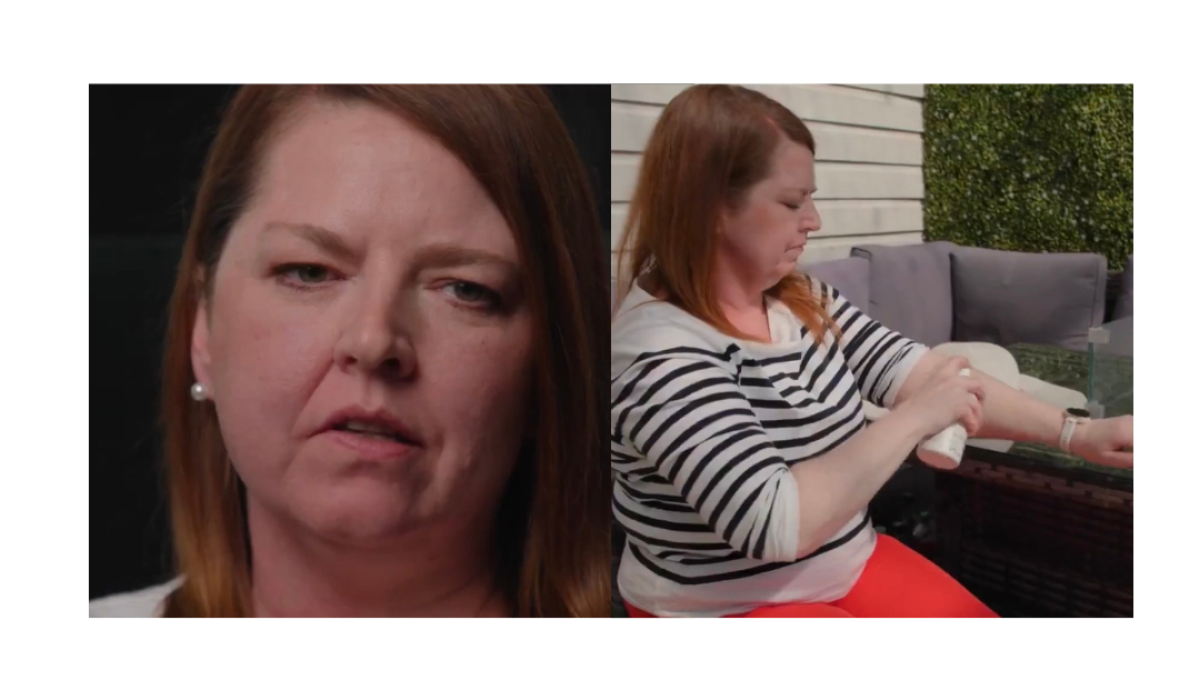 Irish woman with skin cancer warns people ahead of extreme 29 degree ...