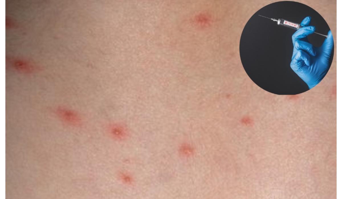 Welcome news for parents as chickenpox vaccine to be made free for ...